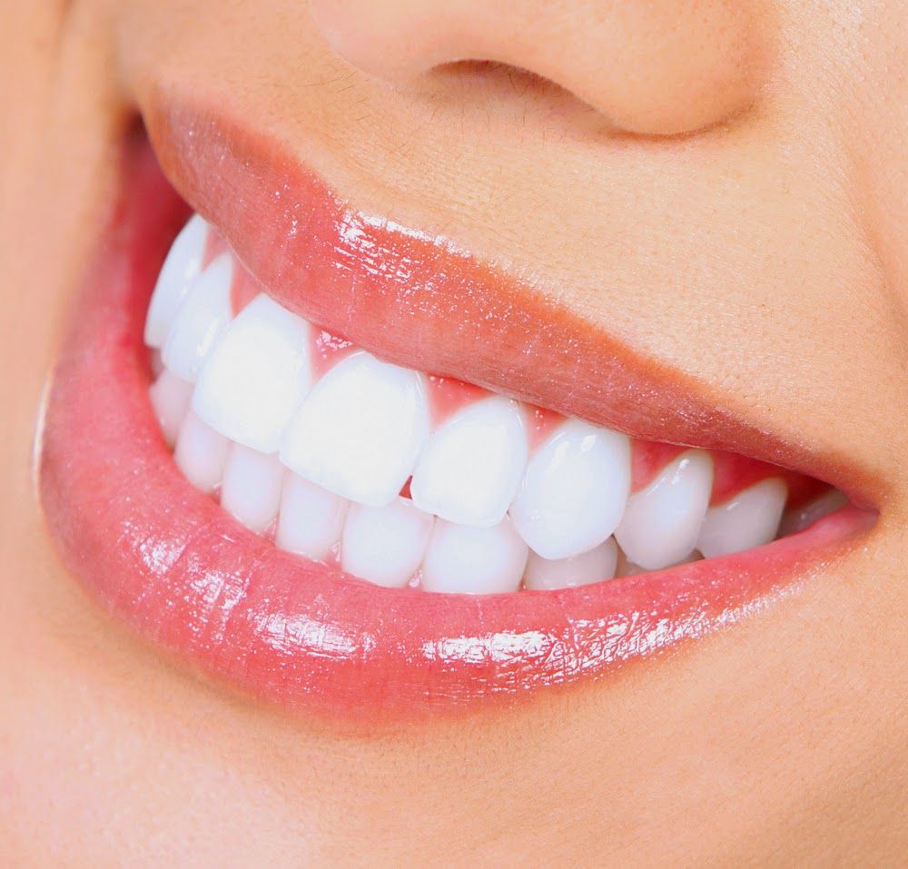 The Benefits of Fluoride Treatment: Strengthening Your Smile Naturally ...